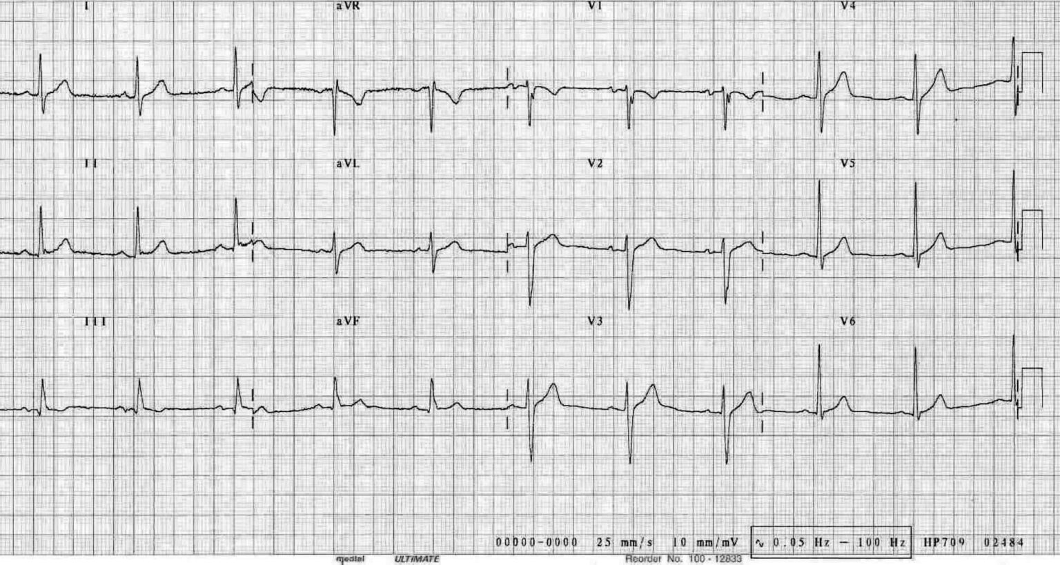 AMRG Cardiac Atlas - Cardiac Atlas Project
