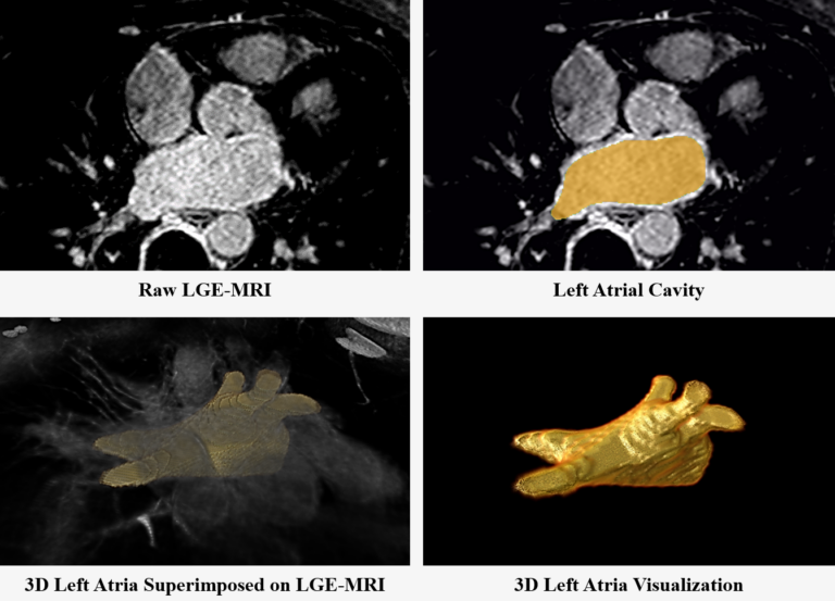 Cardiac Atlas Project - sharing a large-scale database of cardiac ...