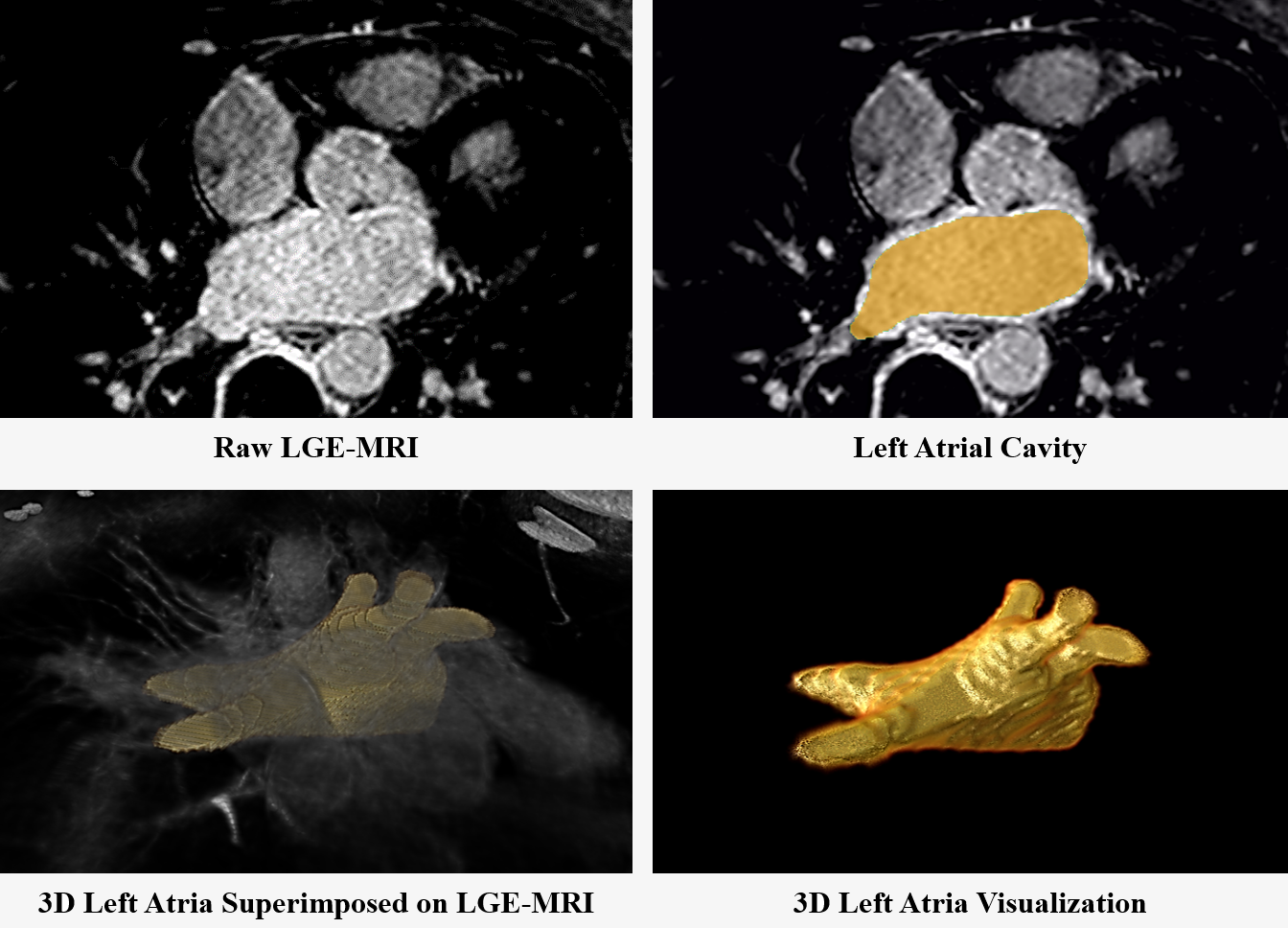 Cardiac Atlas Project - sharing a large-scale database of cardiac ...